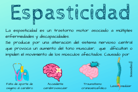 ¿Que es la espasticidad? - Somosdisc@