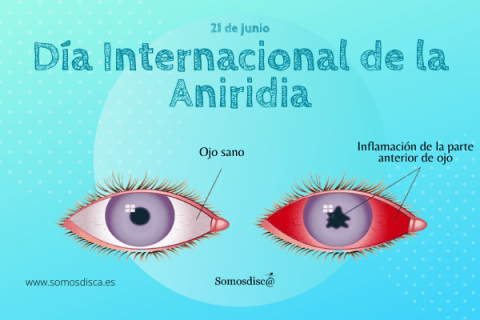 Día internacional de la Aniridia - Somosdisc@