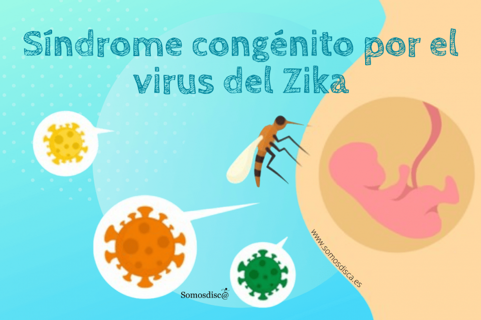 Síndrome Congénito Por El Virus Del Zika Somosdisc