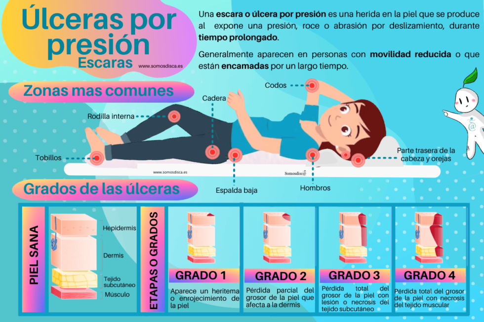 Infografía de las Úlceras por presión - Somosdisc@