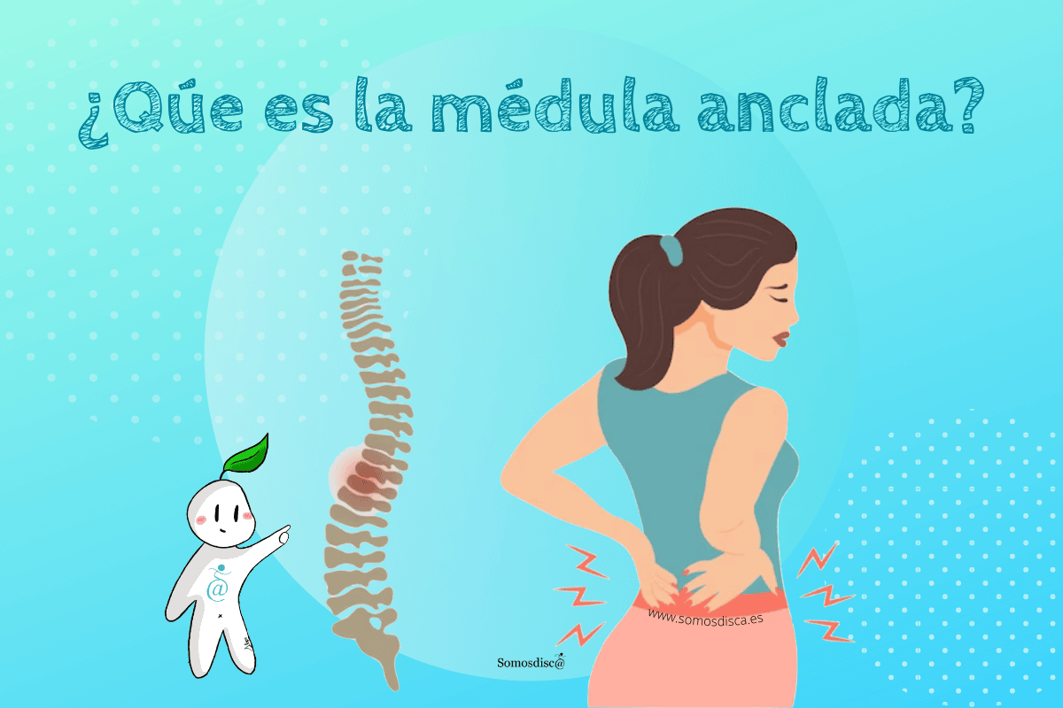 ¿Qué es la médula anclada? - Somosdisc@