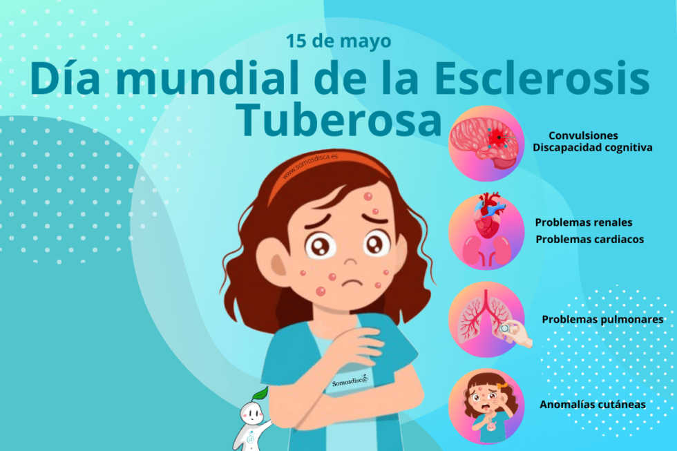 Día mundial de la Esclerosis Tuberosa 2024 - Somosdisc@