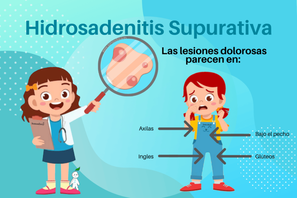 Día mundial de la Hidrosadenitis Supurativa 2024 - Somosdisc@