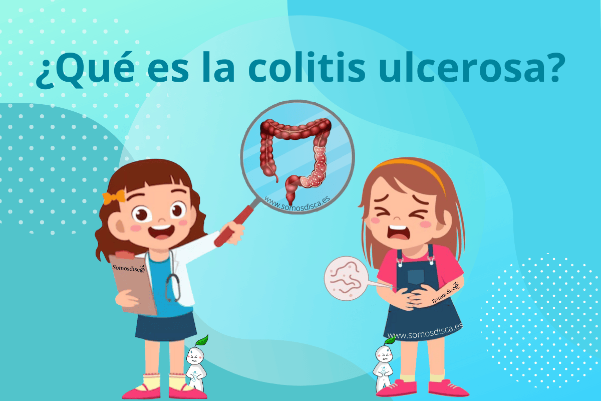 ¿Qué es la colitis ulcerosa? - Somosdisc@